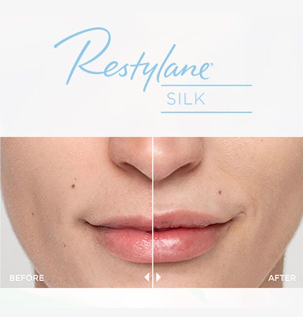 Dallas Restylane Silk - Clinique Dallas Plastic Surgery, Medspa and Laser Center