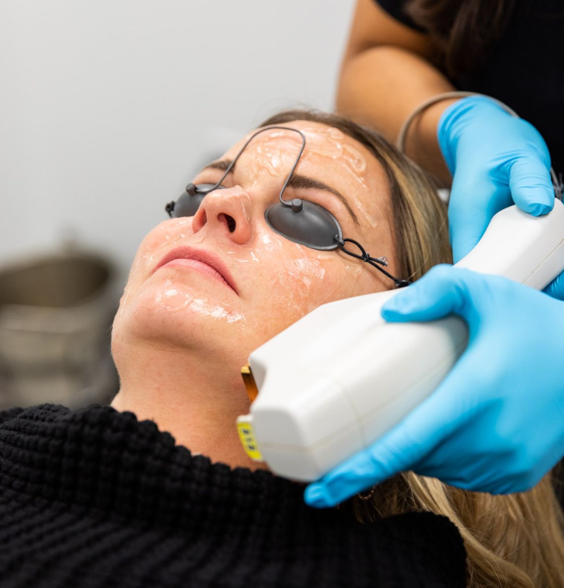 Forever Clear BBL Acne Treatment - Clinique Dallas